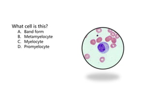 Audio- Visual Round.pptx | Heart and Cardiovascular Diseases | Diseases ...