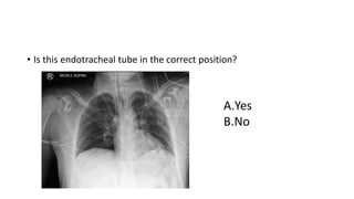 Audio- Visual Round.pptx | Heart and Cardiovascular Diseases | Diseases ...
