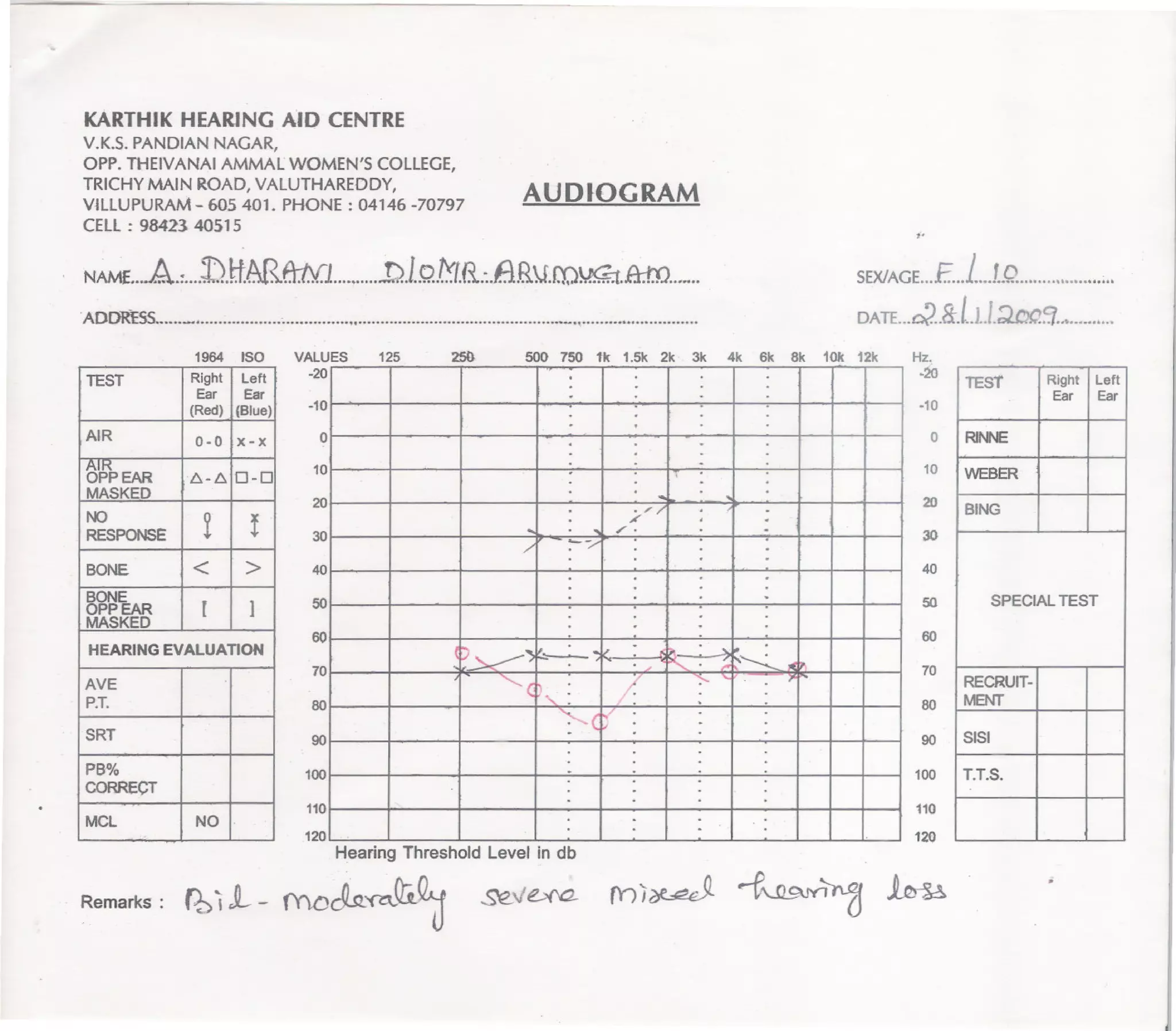 Audiogram 7 children | PDF | Ear, Nose and Throat Conditions | Diseases ...