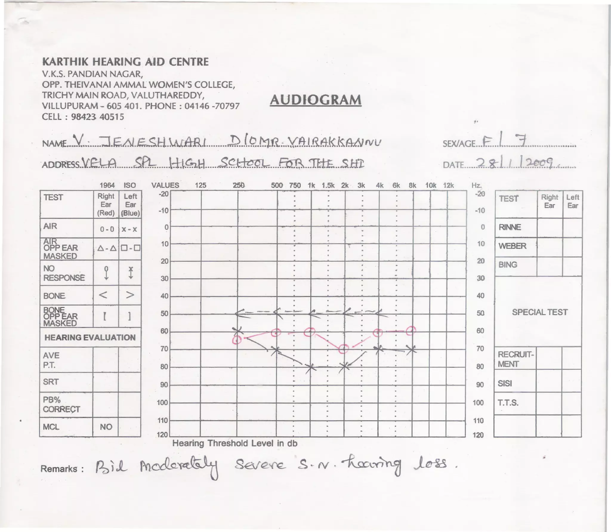 Audiogram 7 children | PDF