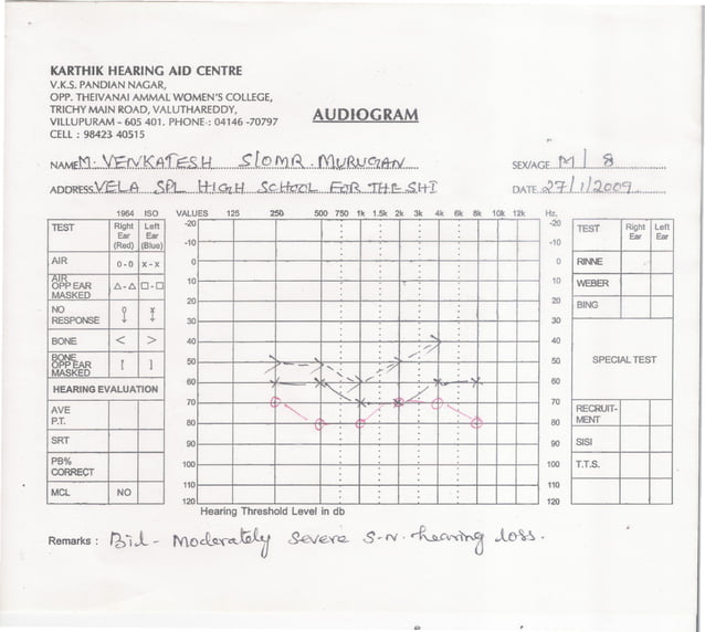 Audiogram 7 children | PPT
