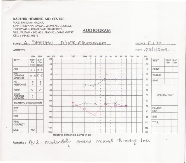 Audiogram 7 children | PPT