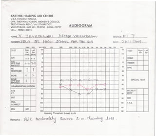 Audiogram 7 children | PDF
