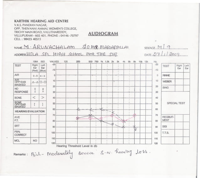 Audiogram 7 children | PPT