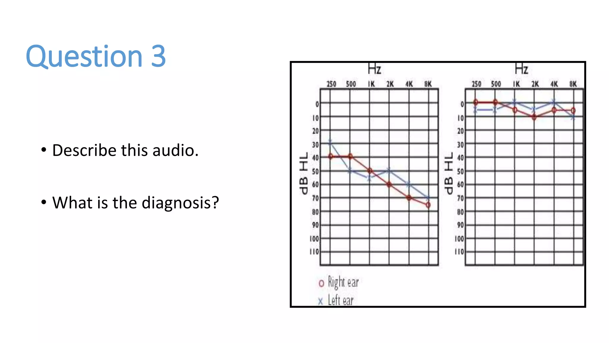 Audiogram and Tympanogram-Dr.Bagasi.pptx