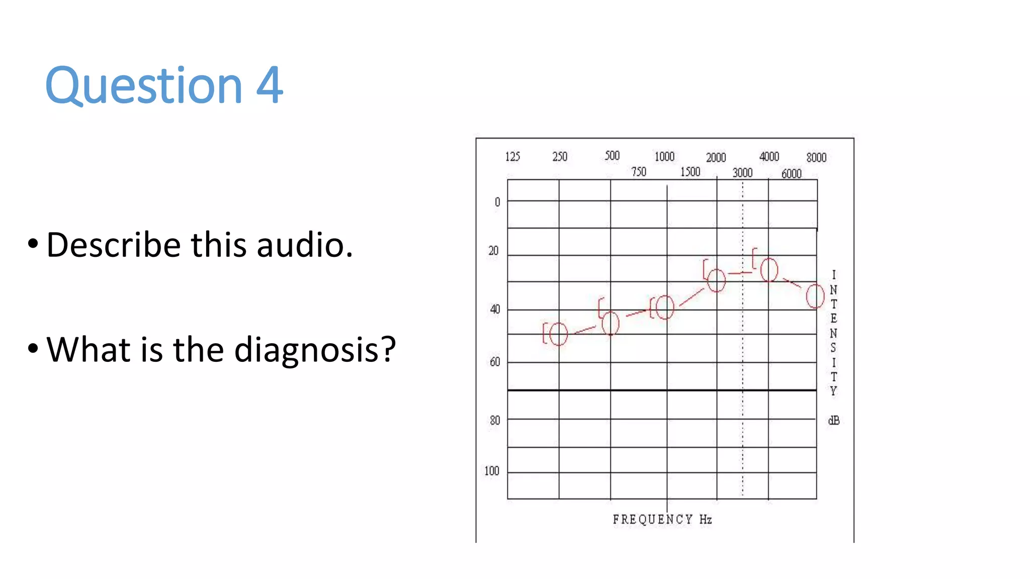 Audiogram and Tympanogram-Dr.Bagasi.pptx