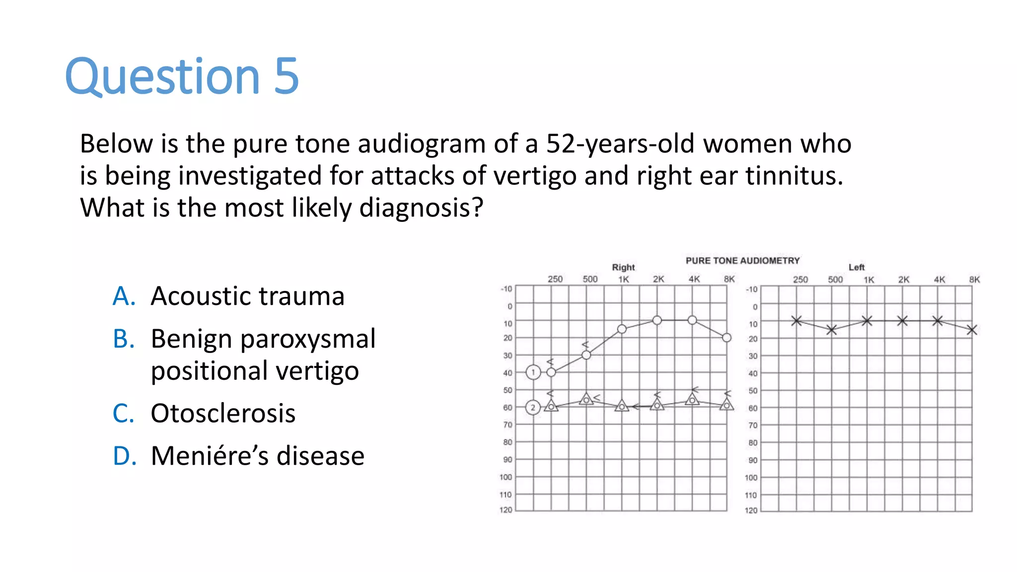 Audiogram and Tympanogram-Dr.Bagasi.pptx