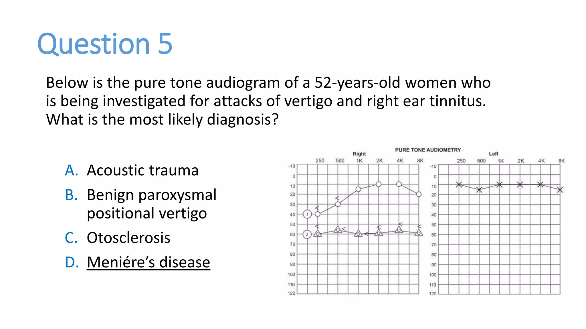 Audiogram and Tympanogram-Dr.Bagasi.pptx