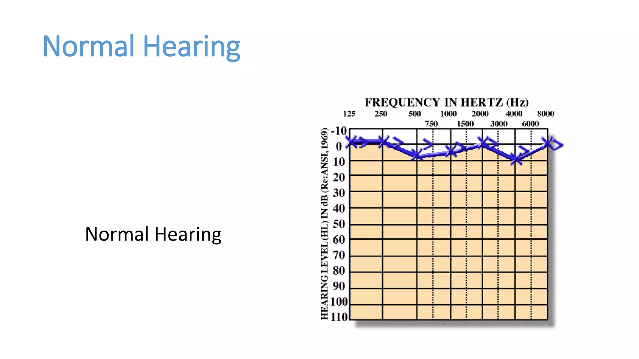 Audiogram and Tympanogram-Dr.Bagasi.pptx