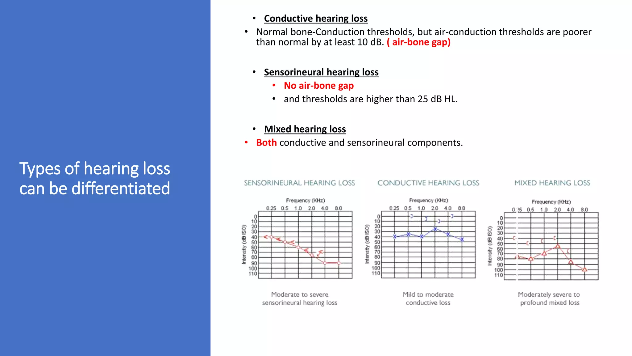 Audiogram and Tympanogram-Dr.Bagasi.pptx