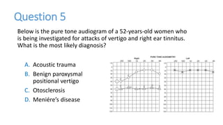 Tympanic Membrane Perforation Audiogram