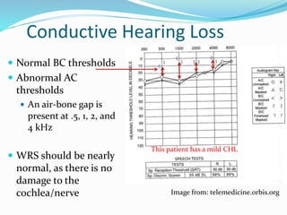 Audiogram interpretation | PPTX | Ear, Nose and Throat Conditions ...