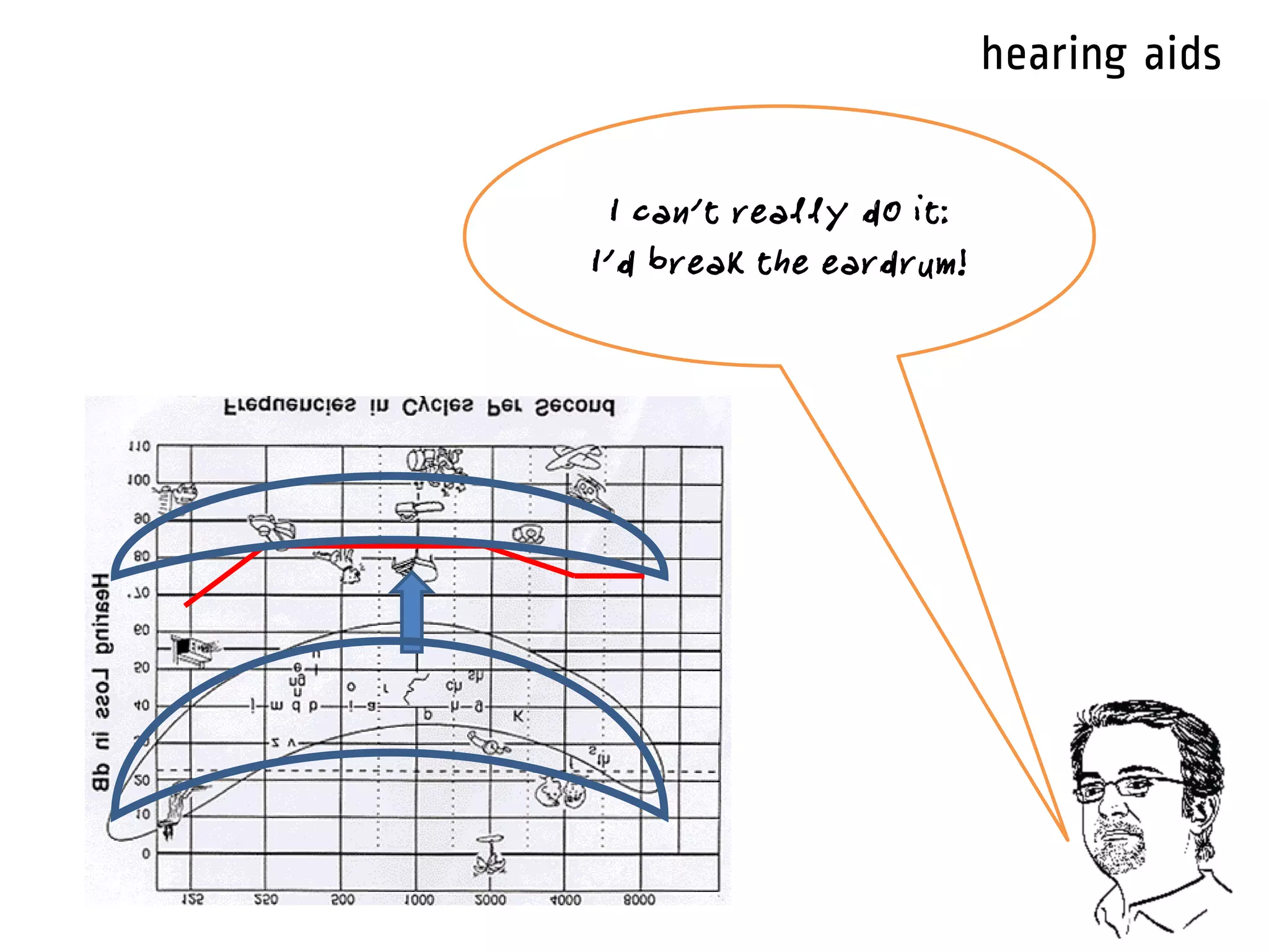 Audiogram, hearing aids, cochlear implant rev. 2 | PPT