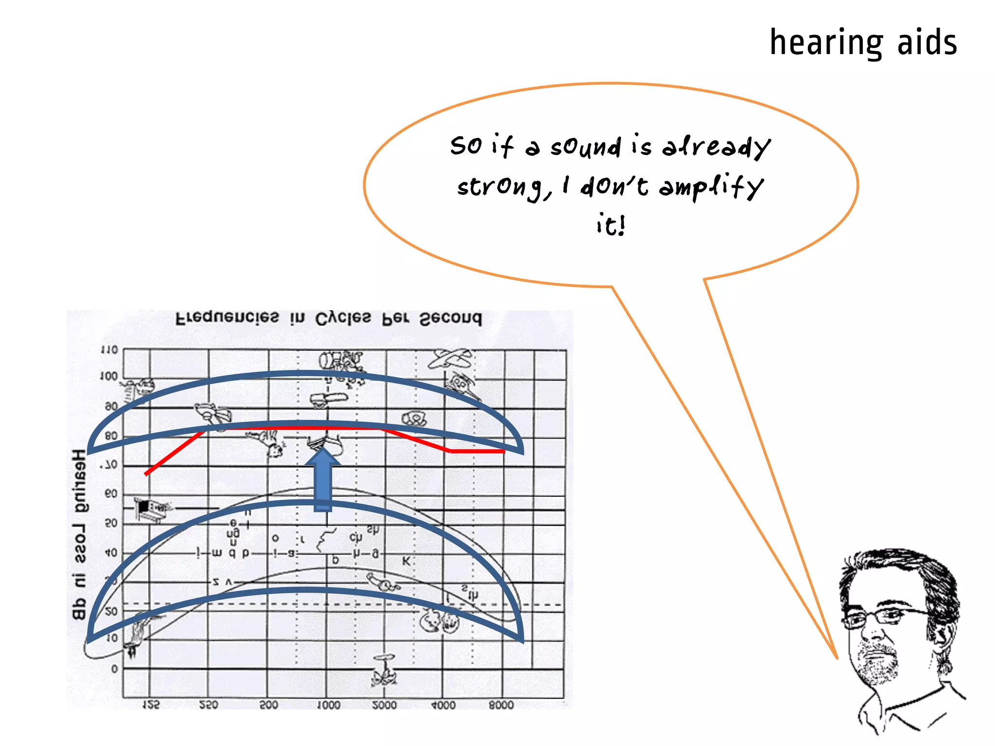 Audiogram, hearing aids, cochlear implant rev. 2 | PPT