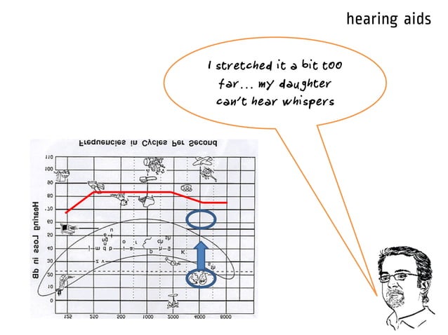 Audiogram, hearing aids, cochlear implant rev. 2 | PPT