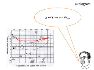 Audiogram, hearing aids, cochlear implant rev. 2 | PPT