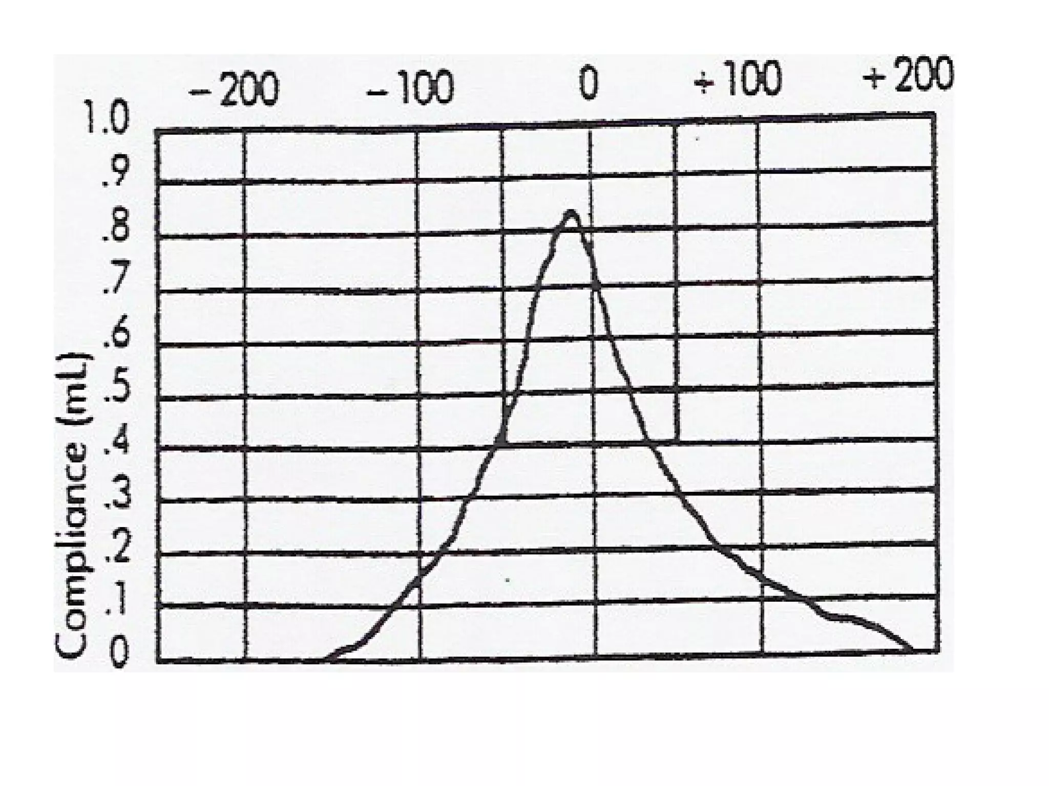 Audiogram Tympanogram Ppt