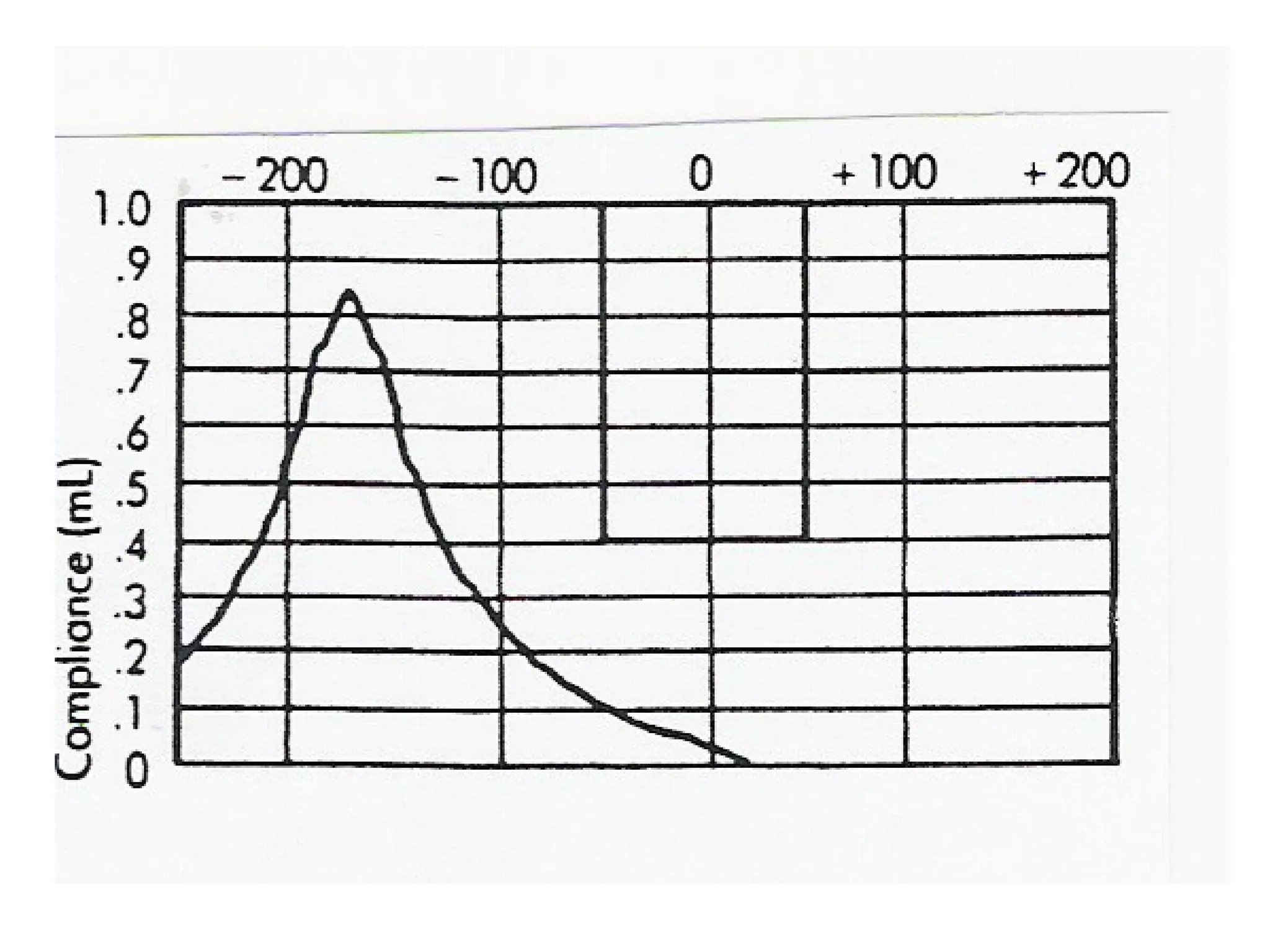 Audiogram Tympanogram Ppt