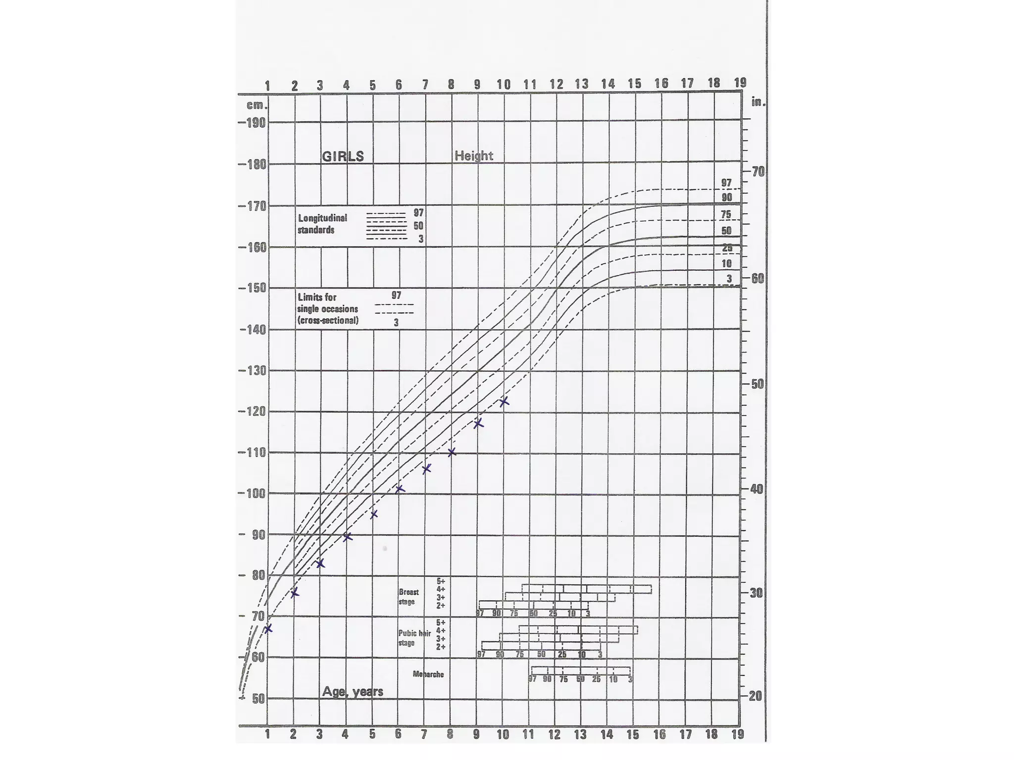 Audiogram Tympanogram Ppt
