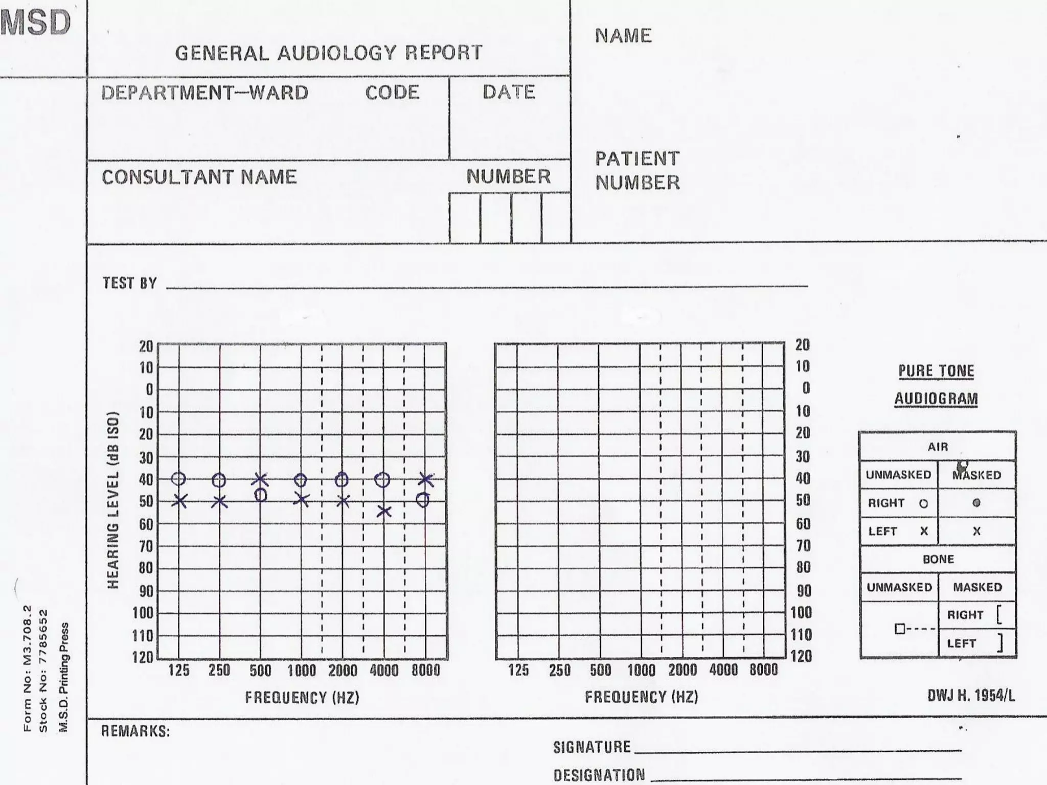 Audiogram Tympanogram Ppt