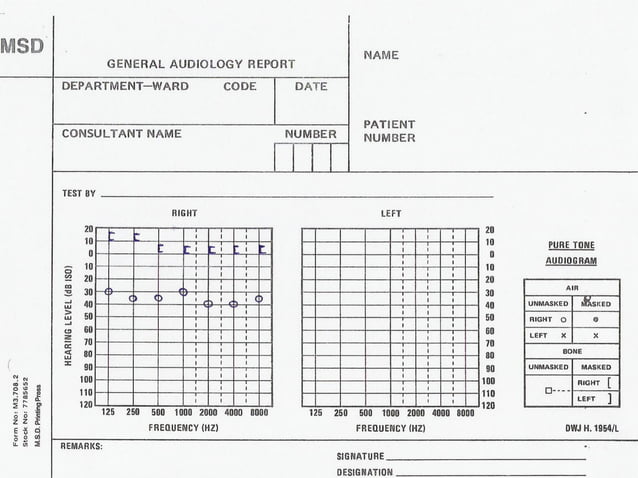 Audiogram & Tympanogram | PPT