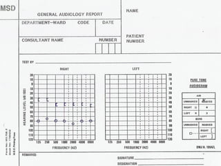 Audiogram & Tympanogram | PPT