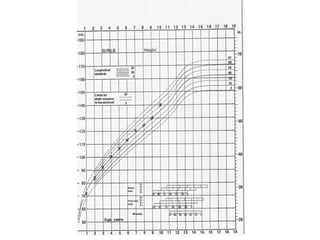 Audiogram & Tympanogram | PPT