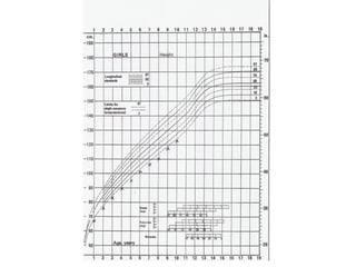 Audiogram & Tympanogram | PPT