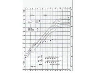 Audiogram & Tympanogram | PPT