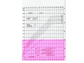 Audiogram & Tympanogram | PPT