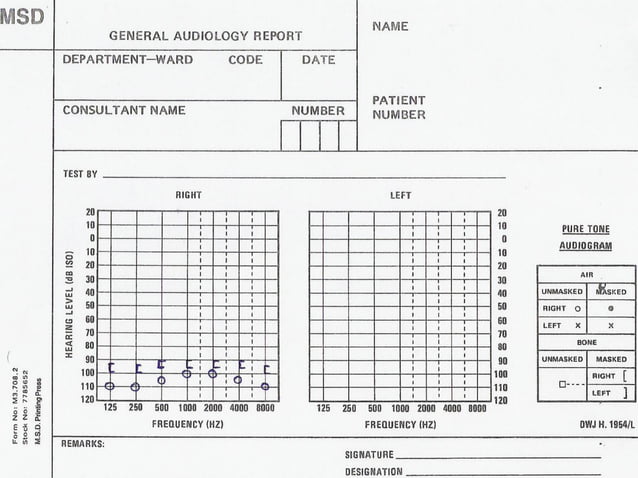 Audiogram & Tympanogram | PPT