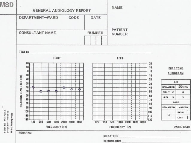 Audiogram & Tympanogram | PPT