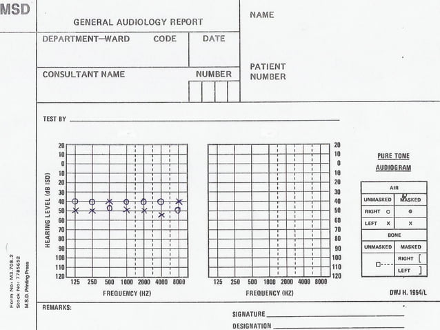 Audiogram & Tympanogram | PPT