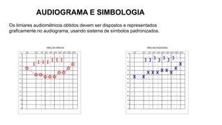 AUDIOLOGIA I - AULA 5.pptx