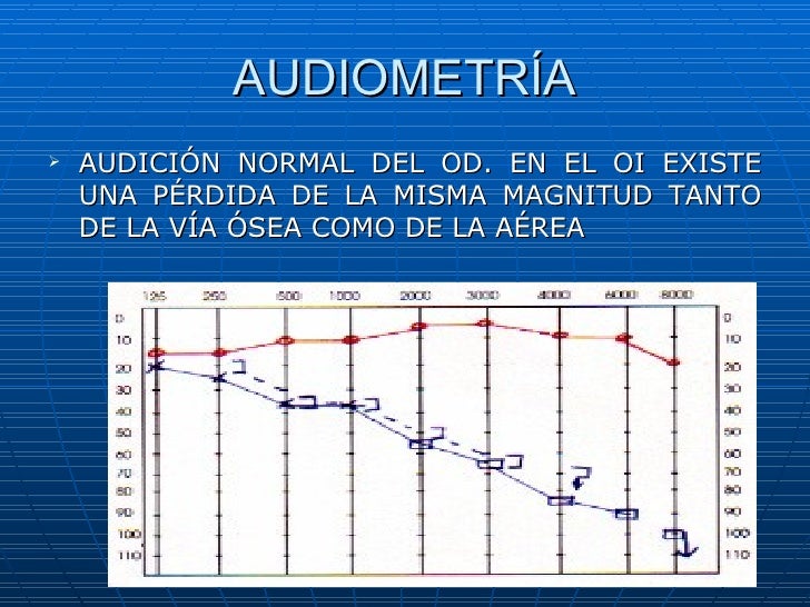 Audiologia y estudios audiometricos