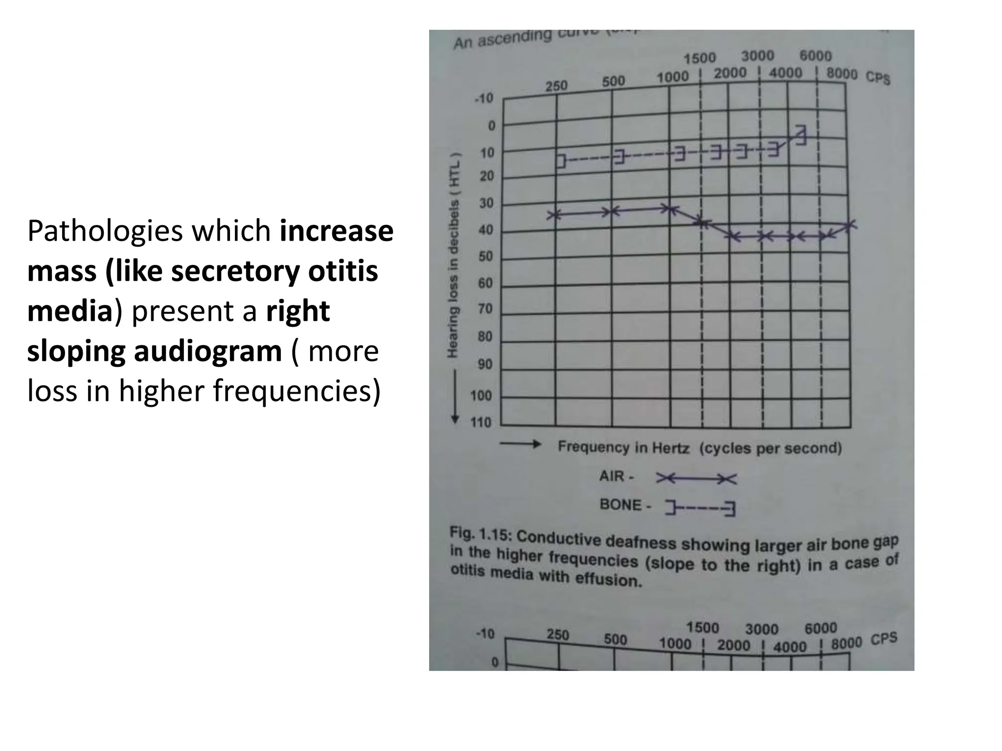Audiological tests of hearing assessment | PPTX