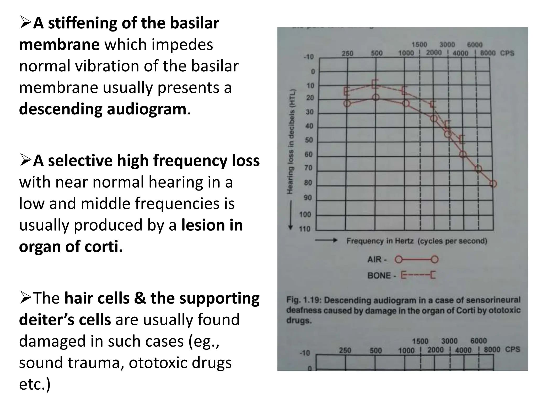 Audiological tests of hearing assessment | PPTX