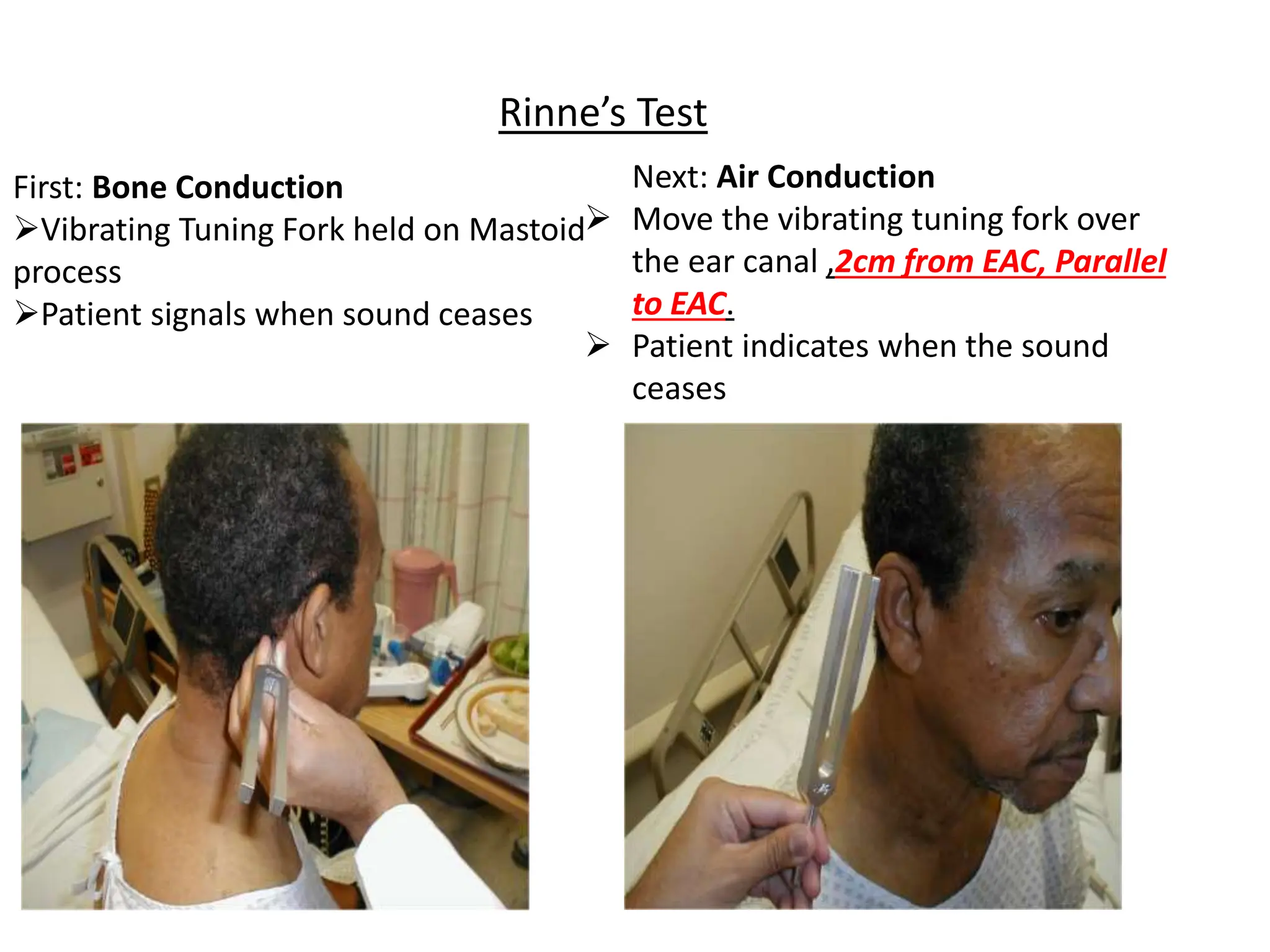 Audiological tests of hearing assessment | PPTX