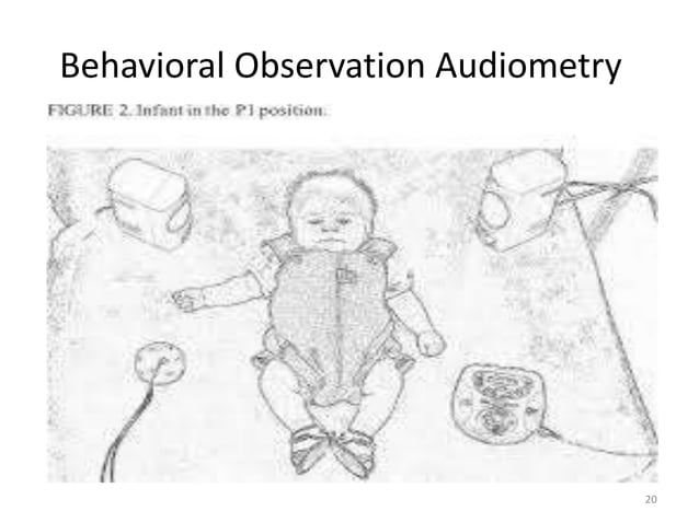 Audiological tests of hearing assessment | PPTX