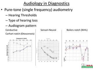 Audiology, speech language pathology & rehabilitation | PPTX