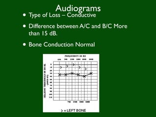 Audiometery soft copy | PPT