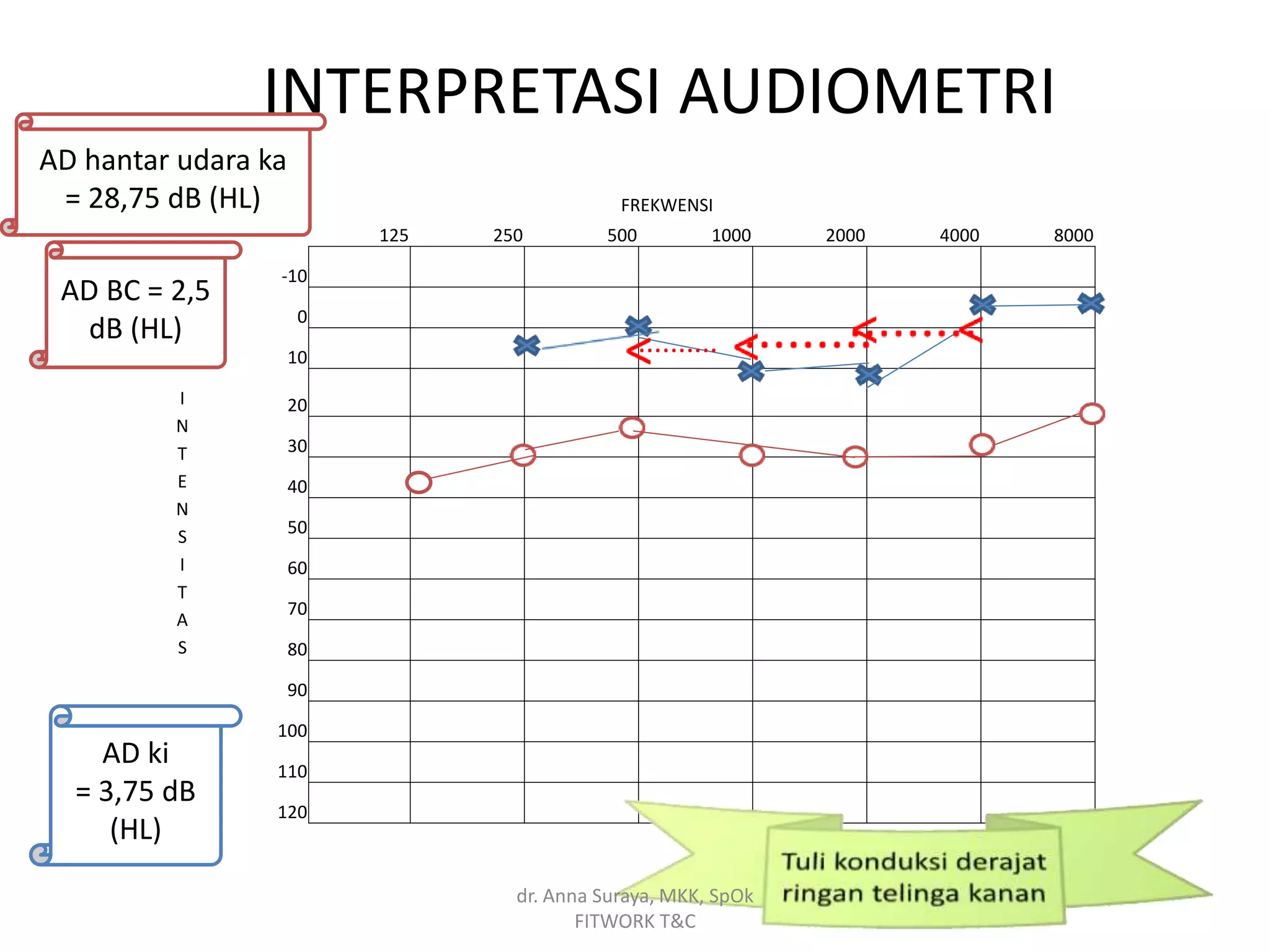Audiometri | PPSX