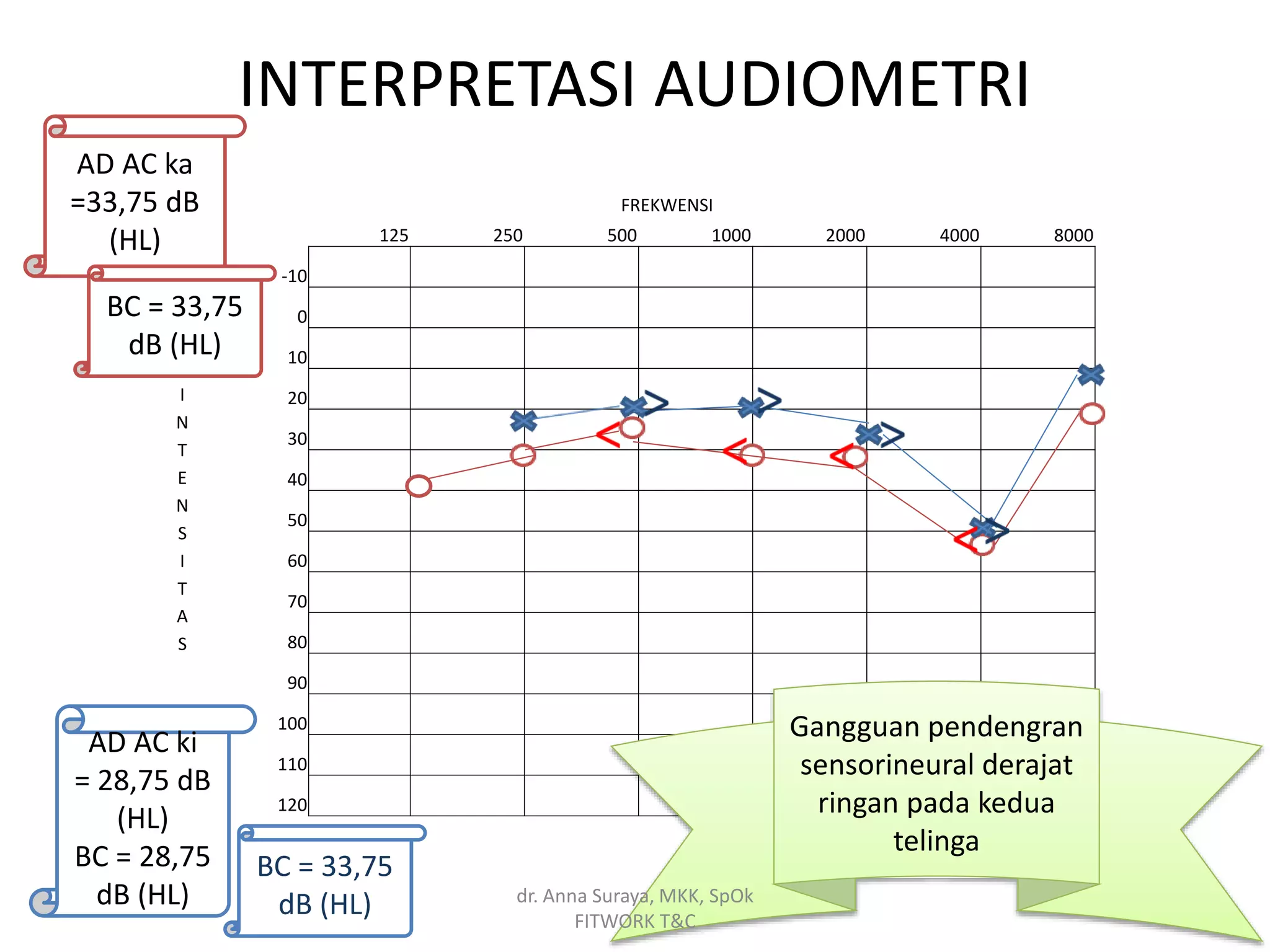 Audiometri | PPSX