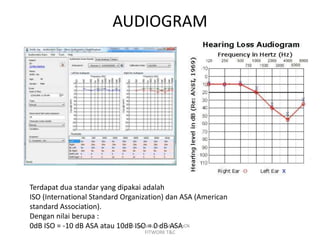 Audiometri | PPSX