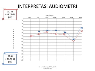 Audiometri | PPSX