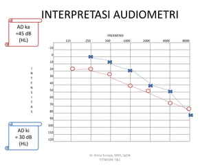 Audiometri | PPSX