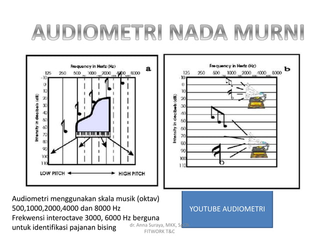 Audiometri | PPSX