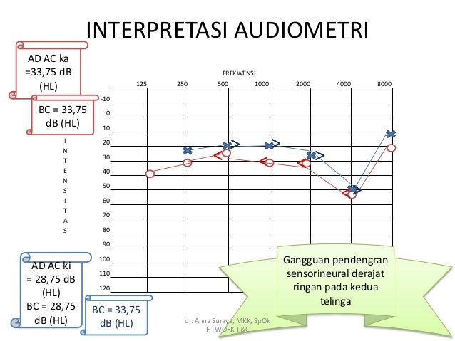 Audiometri