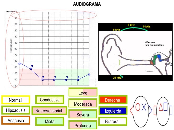 Audiometria