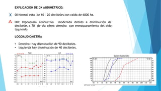 AUDIOMETRIA.pptx